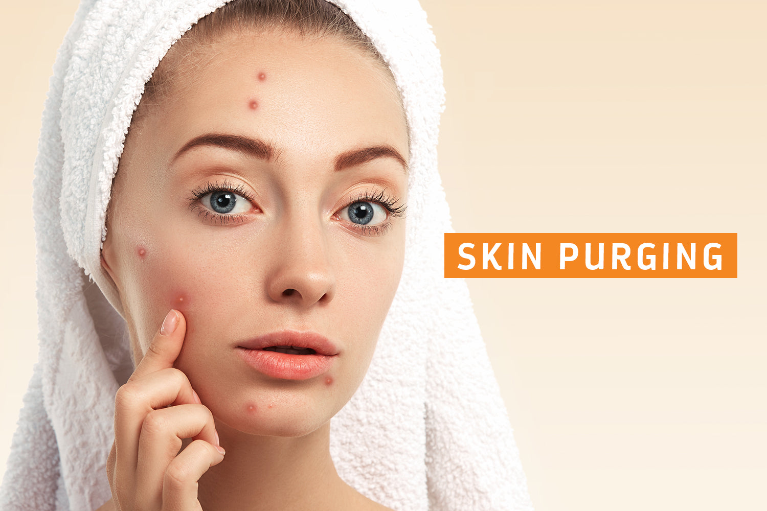 5 Effective Tips to Treat Skin Purging for a Clear Complexion ...