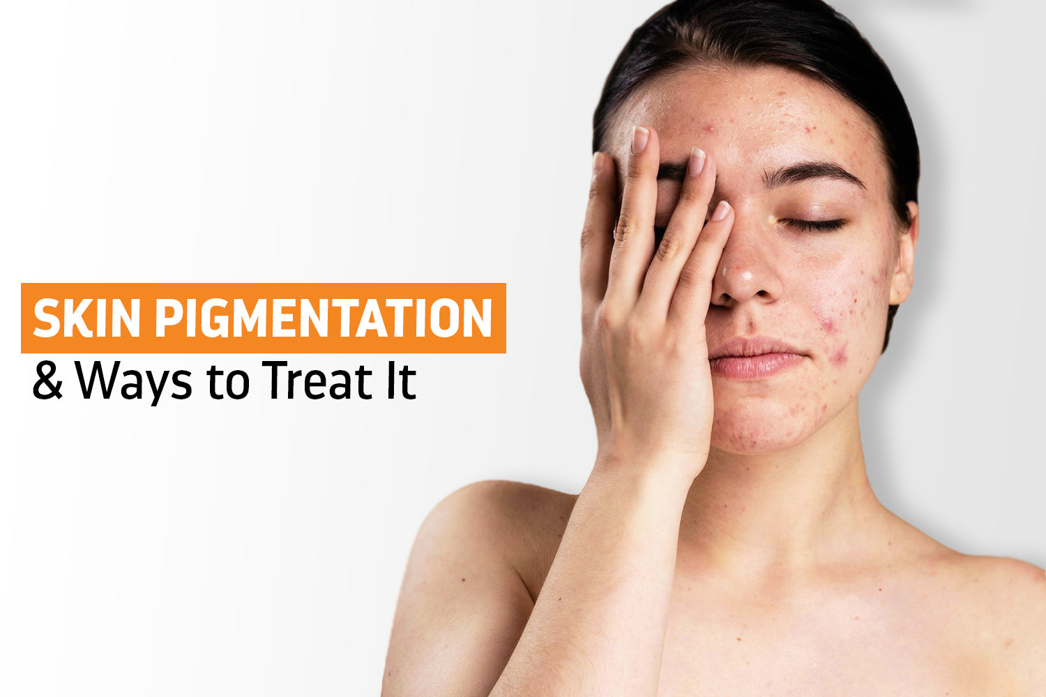Effective Treatments for Skin Pigmentation Issues: Restore Even Skin ...